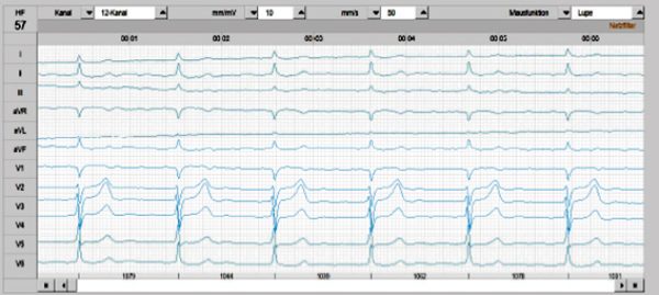 Stoffwechseltherapie des Herzens - Kardiologie Baden-Baden